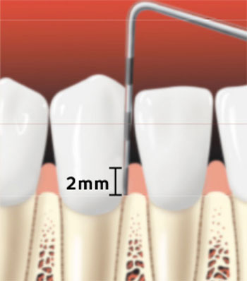ADA Patient Education Winston Salem NC - Ardmore Dentistry